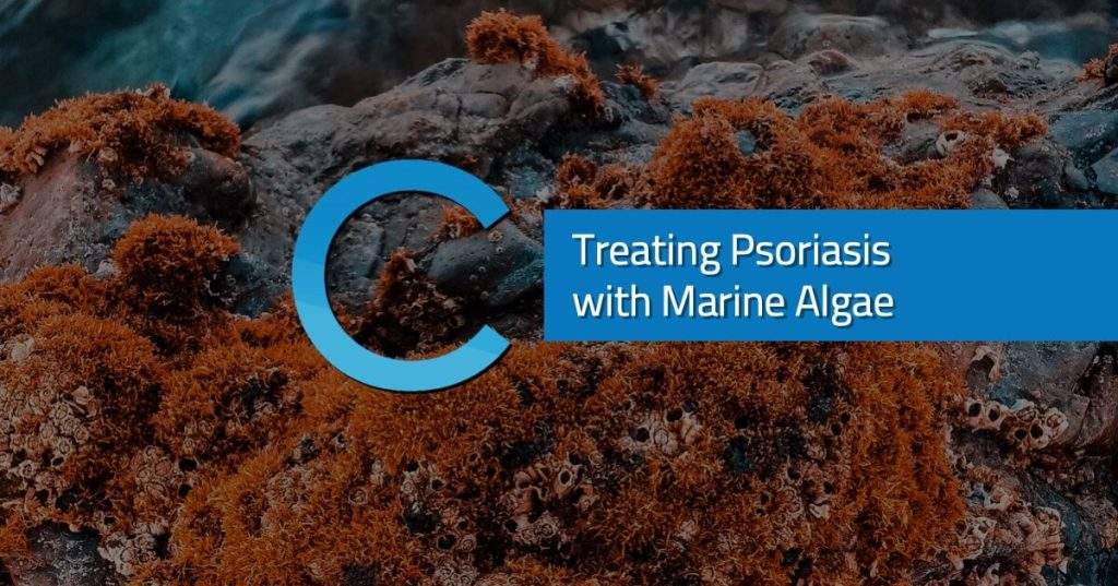 Treating Psoriasis with Marine Algae - Coast Southwest